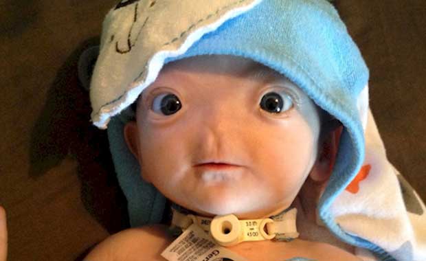 Baby Born Without A Nose Is The Internet's Happiest, Most Adorable Baby ...