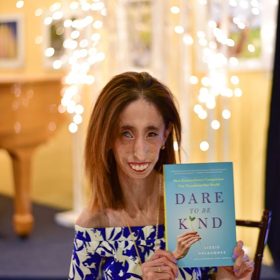 How Lizzie Velásquez Turned Her Pain Into a Platform - Your Daily Dish