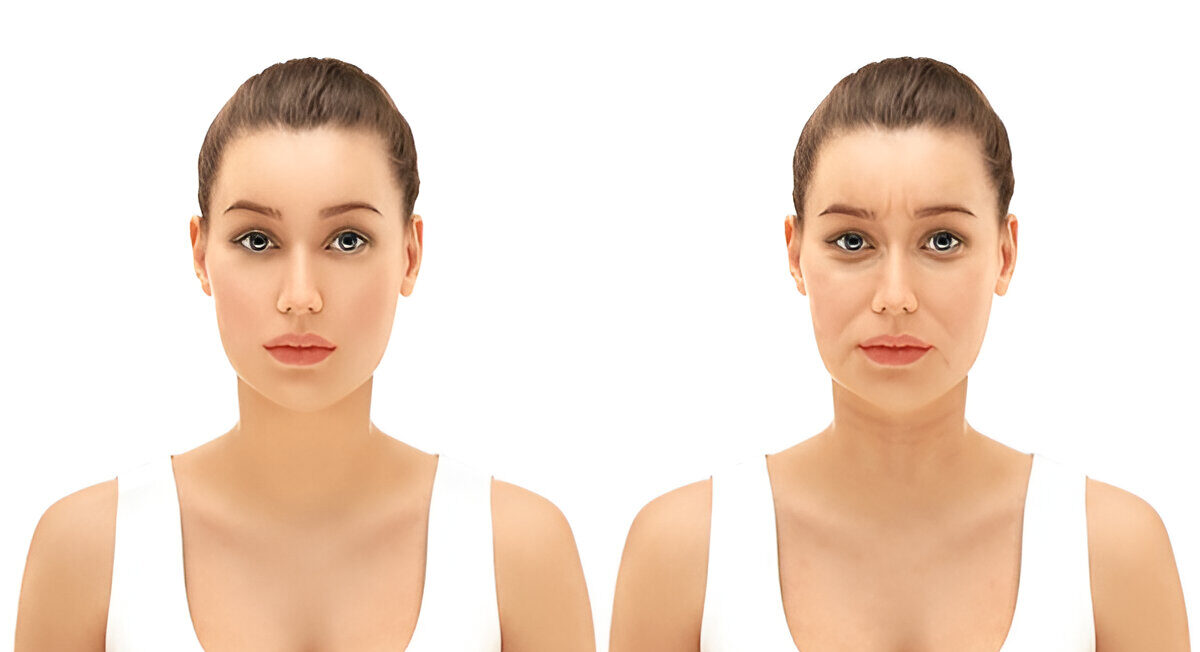 Botox Under Eyes - Benefits, Risks, and Results Explained