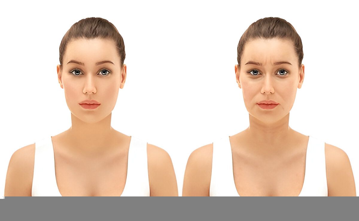 Botox Under Eyes - Benefits, Risks, and Results Explained